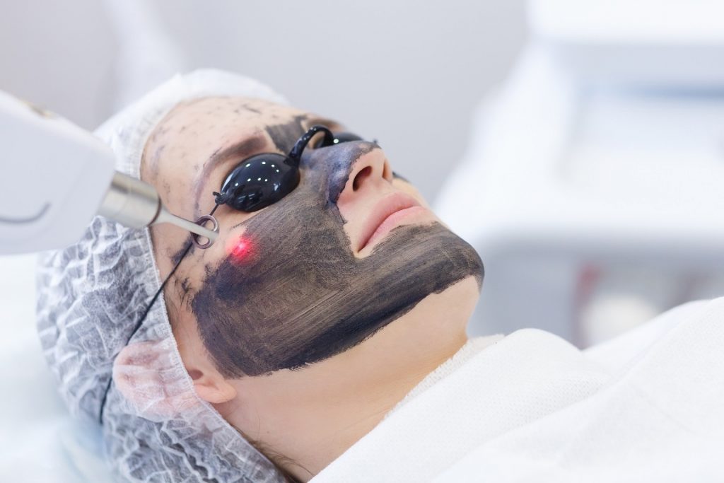 Carbon Laser Facial - Lux Laser and Beauty Clinic